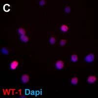 OVCAR-3 Human Ovarian Cancer Cell Line | SCC257
